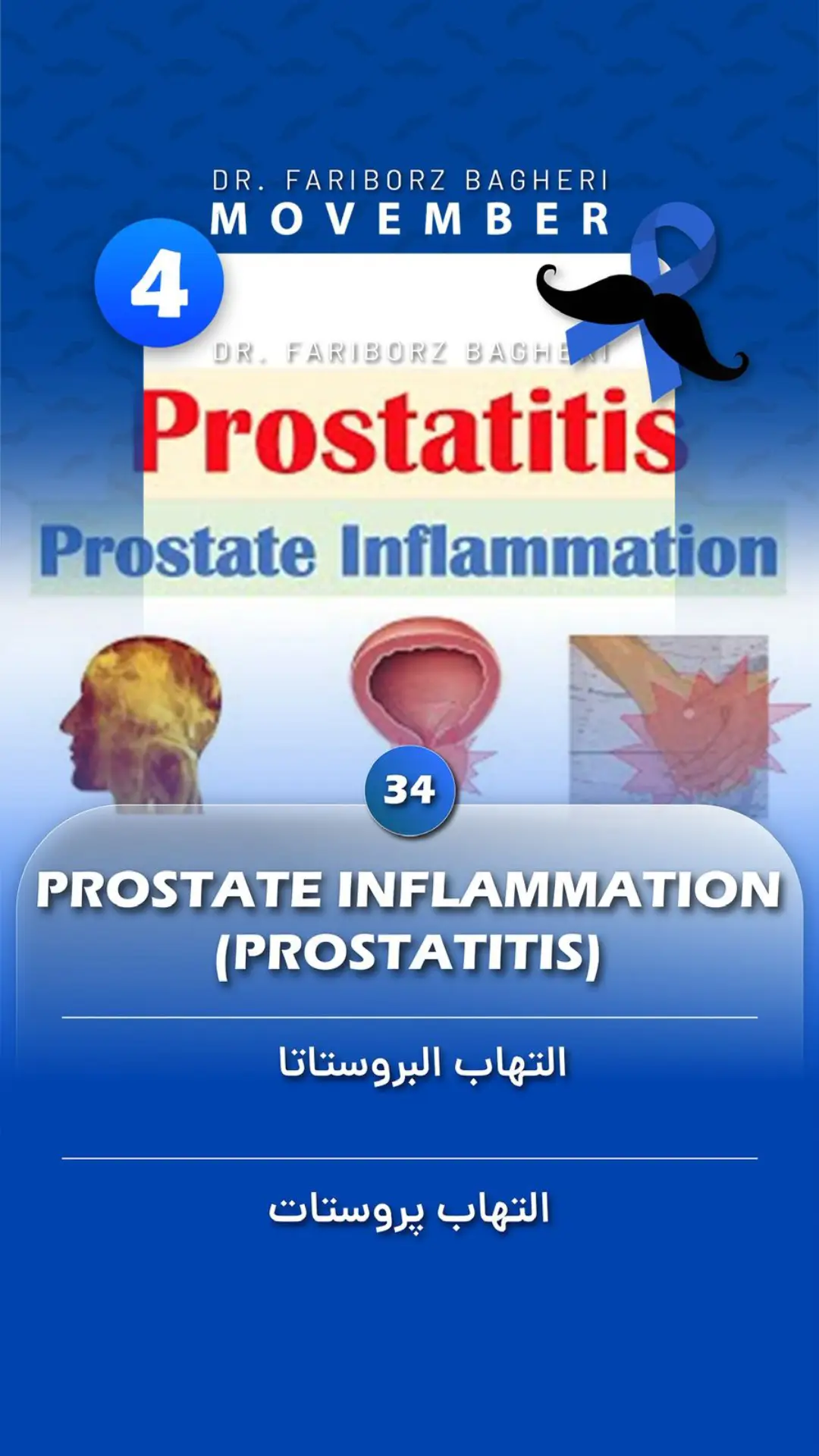 Prostate Inflammation (Prostatitis): Symptoms, Risks & Prevention ...